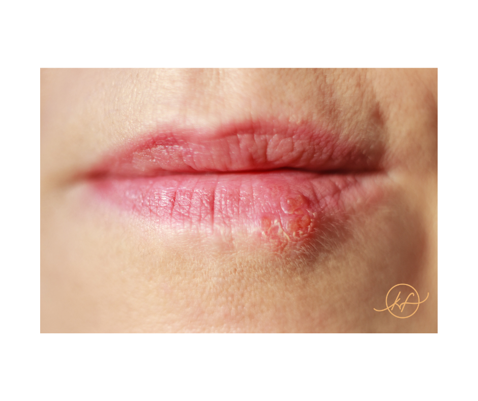 Signs that stress is hiding in your body – Katrina Froome Naturopathy